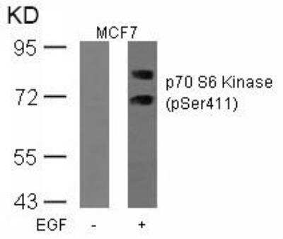 p70 S6 Kinase/S6K [p Ser411] Antibody (NB100-82120): Novus Biologicals